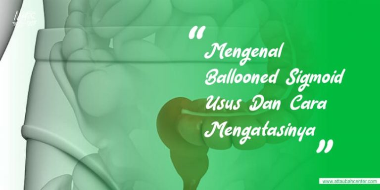 Mengenal Ballooned Sigmoid Usus Dan Cara Mengatasinya – Attaubah Center